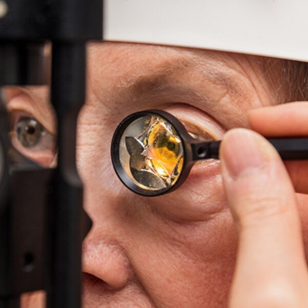 Bệnh Glôcôm là gì? Nguyên nhân, triệu chứng và cách điều trị