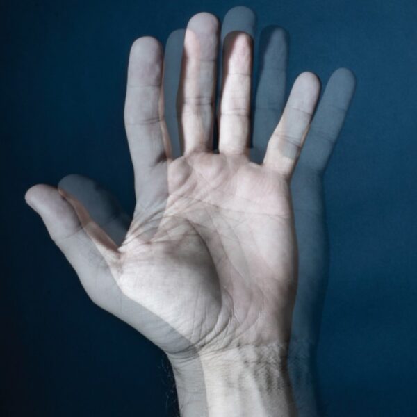 Bị lác mắt là gì? Nguyên nhân, triệu chứng và cách điều trị