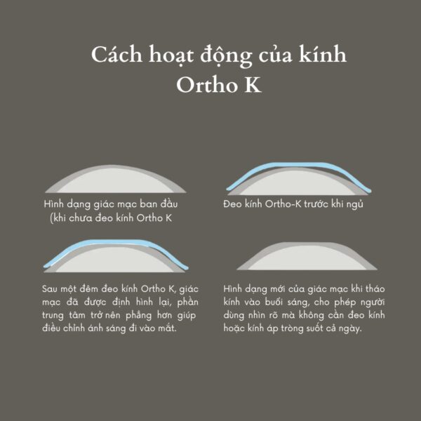 Kính Ortho K là gì, có tốt không, giá bao nhiêu? Review A-Z